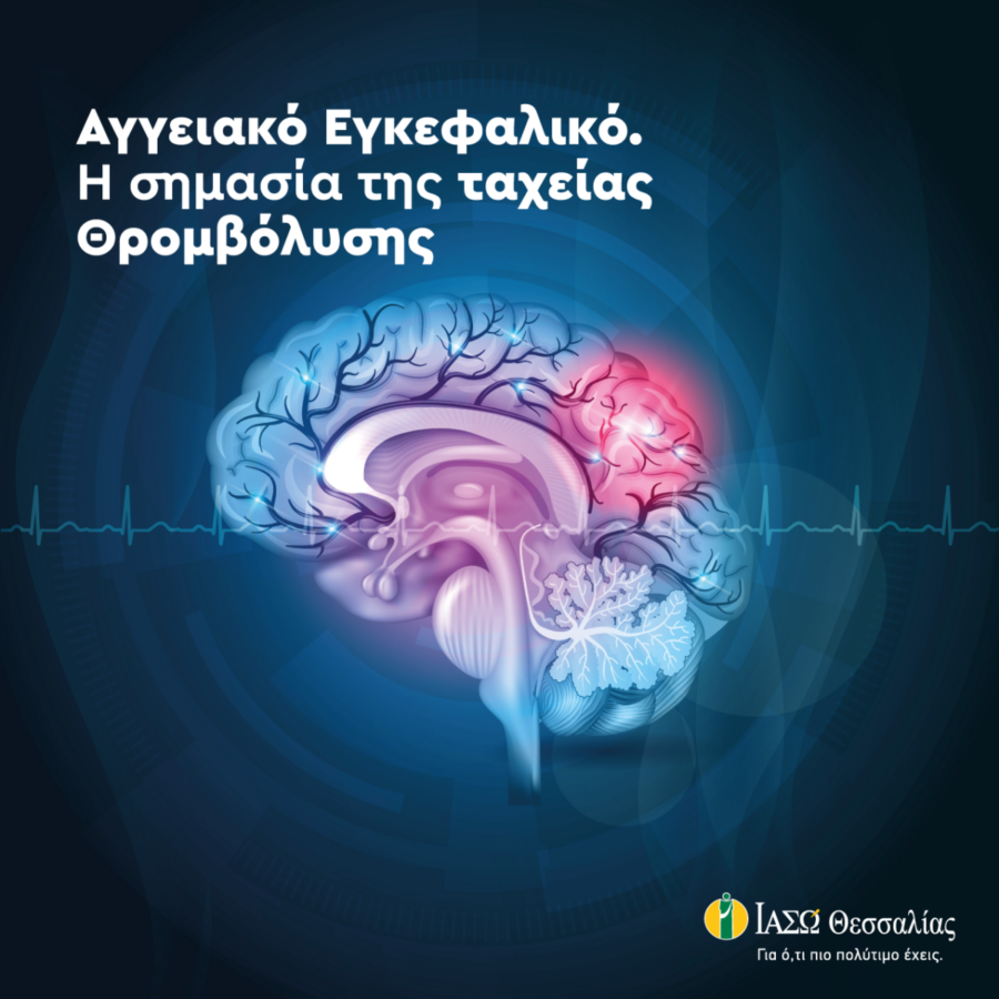 ΙΑΣΩ Θεσσαλίας: Αγγειακό Εγκεφαλικό Επεισόδιο- Η σημασία της ταχείας ...